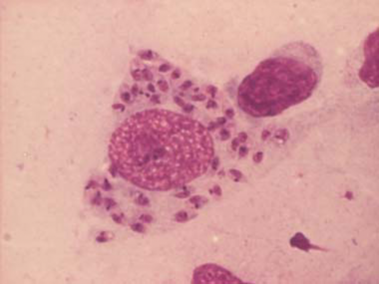 Snabbare diagnostik av leishmania med PCR | Vårdfokus